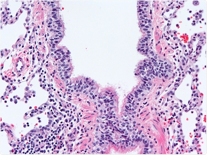 ‘Staining’ of Biological Samples when Using Electron Microscopy