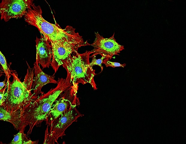 Considering evolution of the cancer genome in metastatic disease