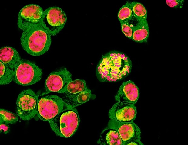 Deep Learning in Fluorescence Microscopy