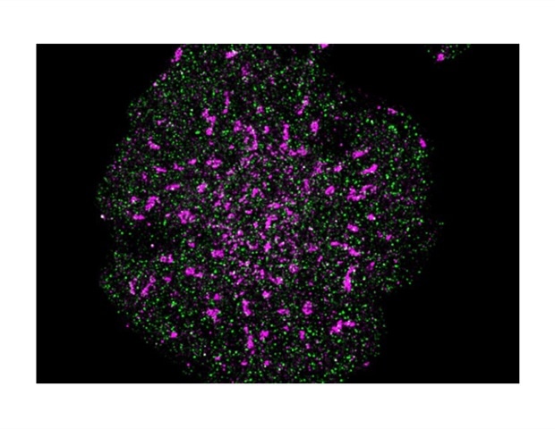 Super-resolution fluorescence microscopy offers first molecular view ...