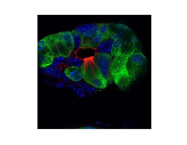 Study reveals the formation of tuft cells and their role in immunity