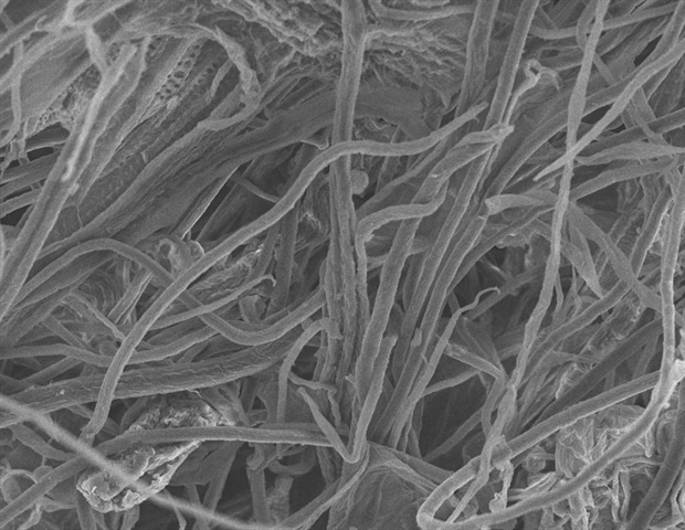 Breaking Down Stubborn Cellulose In Time Lapse